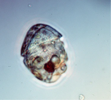 How to build an eye - Gabriel Dall'Alba